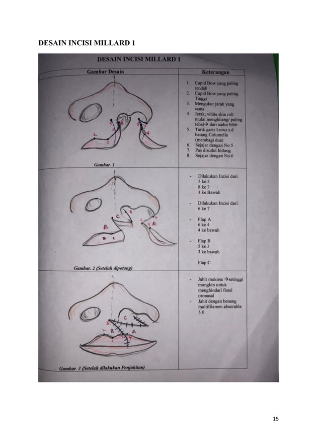 Penatalaksanaan cleft lip palate sumbing aai | PDF