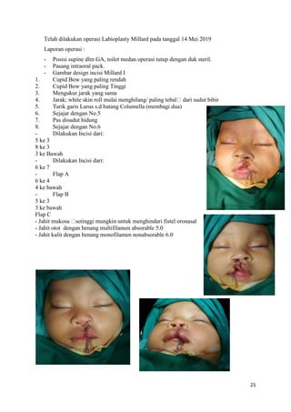 Penatalaksanaan cleft lip palate sumbing aai | PDF