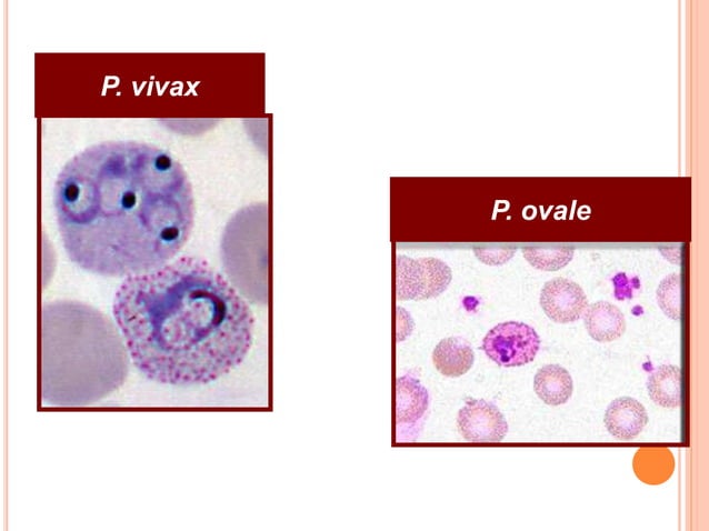 Penatalaksanaan Febris.pptx