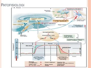 Penatalaksanaan Febris.pptx