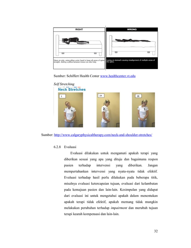 Penatalaksanaan fisioterapi pada kasus brakhialgia ec spondiloarthrosis ...