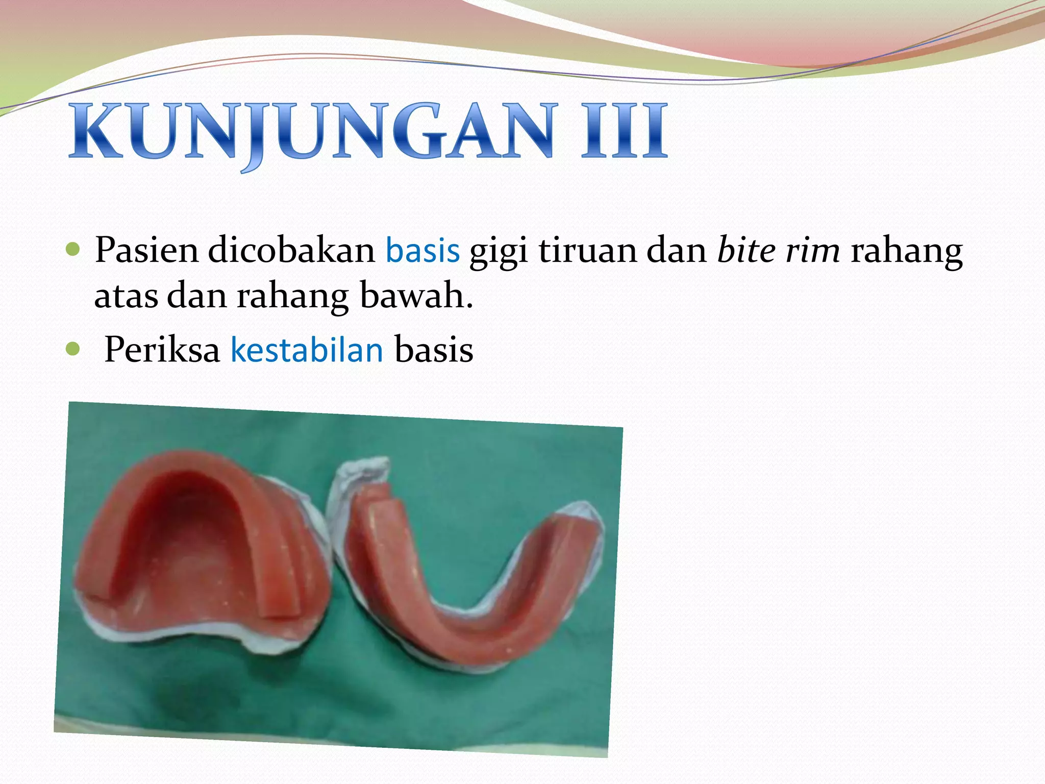Penatalaksanaan gigitiruan penuh lepasan pada pasien edentulous ppt ...
