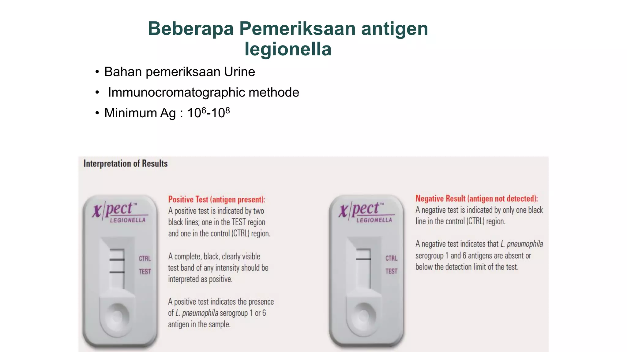 Penatalaksanaan Legionella.pdf