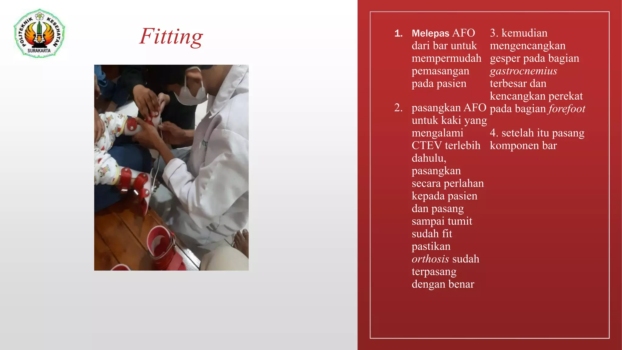 Penatalaksanaan pasien congenital talipes equinus varus bilateral ...