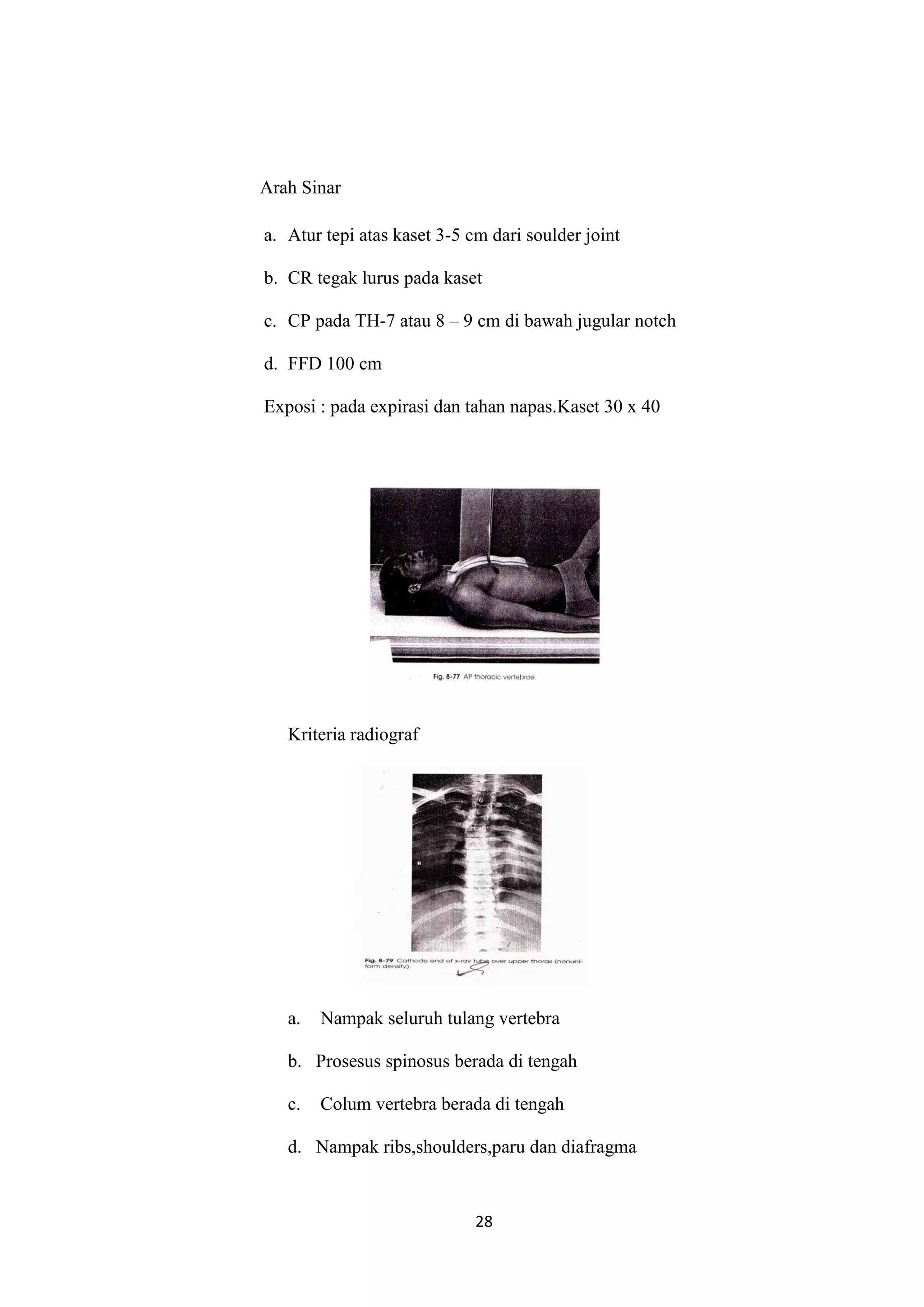 Penatalaksanaan radiografi vertebrae thoracolumbal dengan klinis skoliosis di instalasi ...