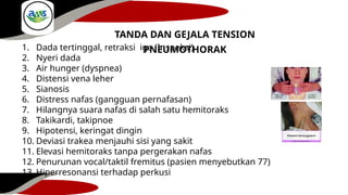 PENATALAKSANAAN TRAUMA THORAKS DAN ABDOMEN.pptx
