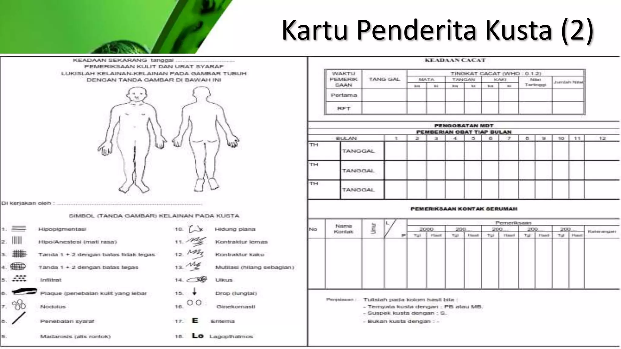 Pencatatan pelaporan kusta | PPTX