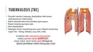 PENCEGAHAN DAN PENGENDALIAN Tuberkulosis | PDF