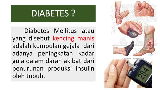 PENCEGAHAN_KOMPLIKASI_PADA_DIABETES.pptx