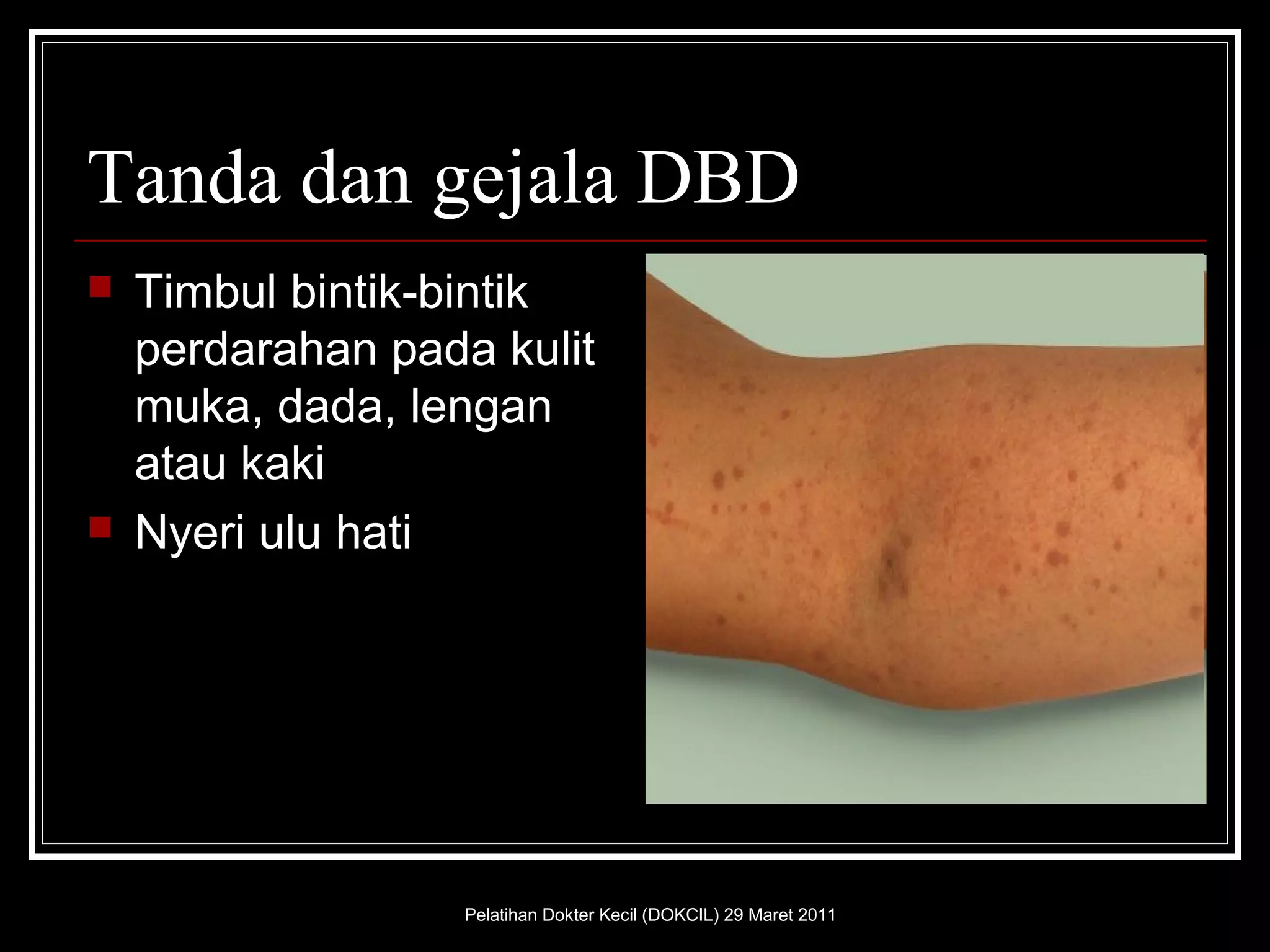 Pencegahan penyakit menular | PPT