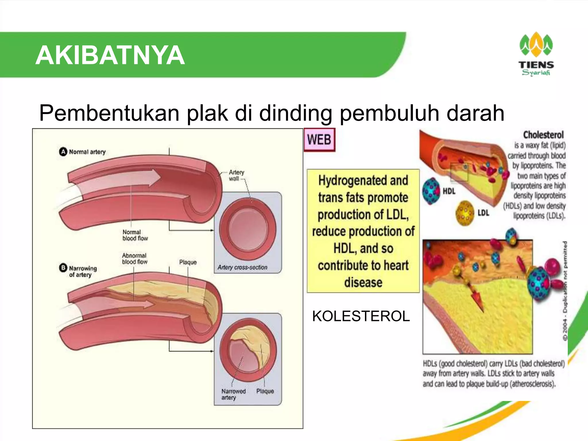 Pencegahan penyakit pembuluh darah jantung dengan terapi gizi TIENS | PPT