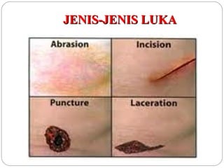 Pendarahan dan renjatani ndustri | PPT