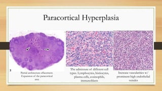 Pendekatan Pola Histopatologi dalam Diagnosis Limfadenopati kelompok B.pdf