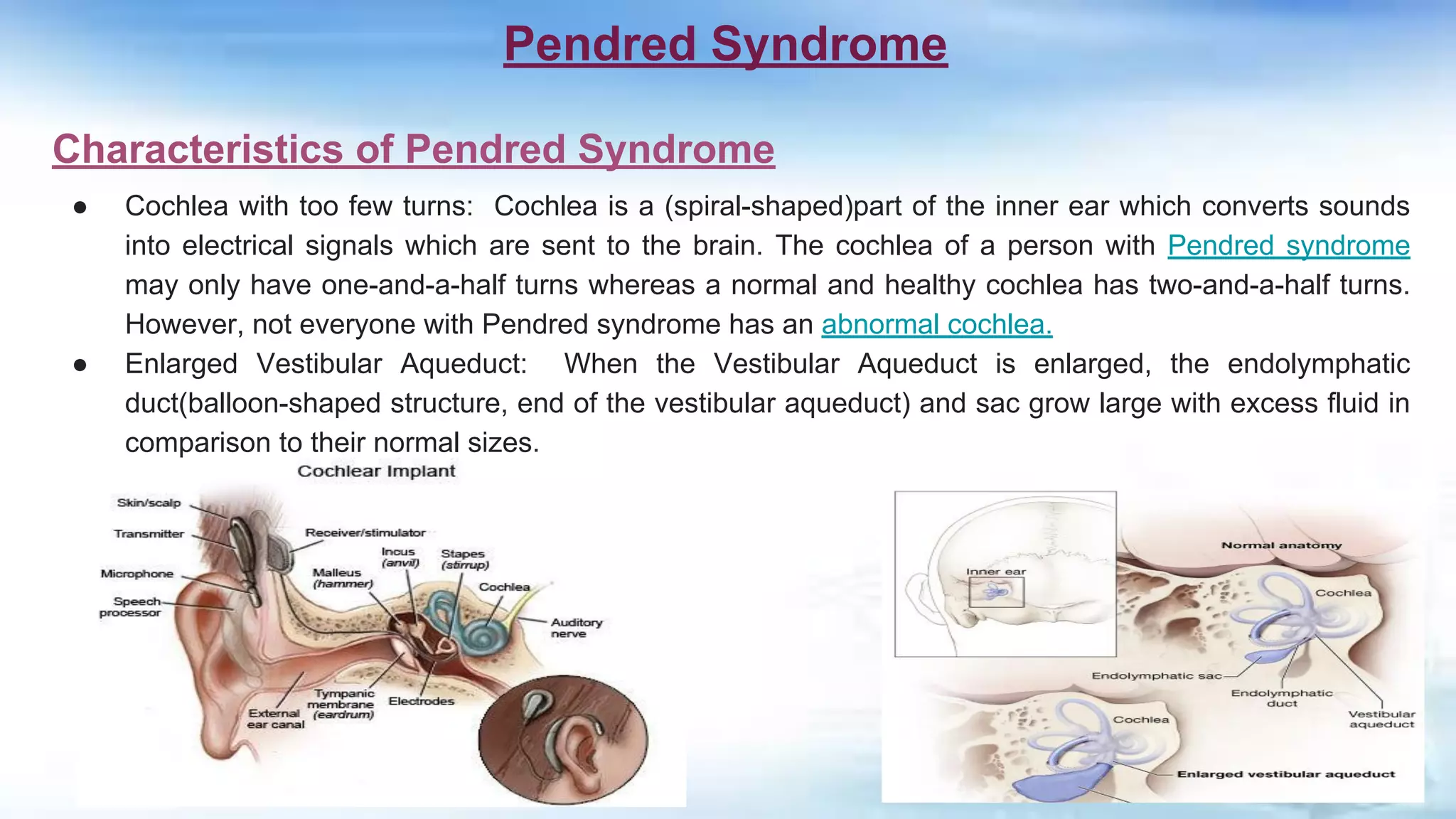 Pendred syndrome causing hearing loss. | PDF