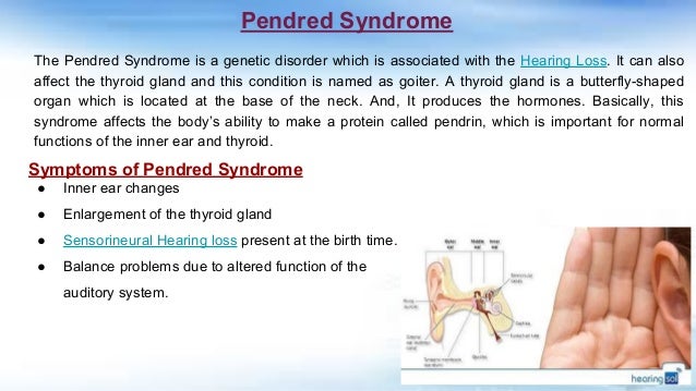 Pendred syndrome causing hearing loss.