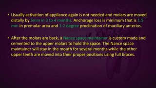 PENDULUM APPLIANCE.pdf