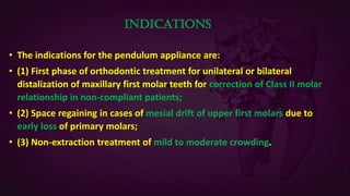 PENDULUM APPLIANCE.pdf