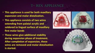 PENDULUM APPLIANCE.pdf