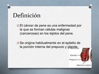 Cáncer de Pene | PPTX