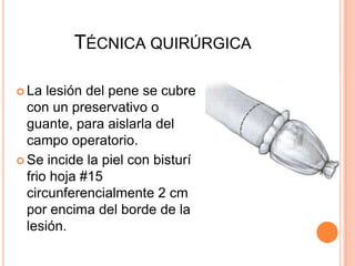 Penectomia expo | PPTX