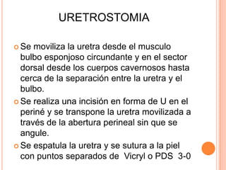 Penectomia expo | PPTX