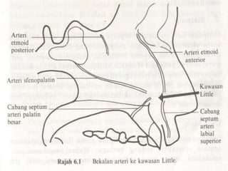 PENEMBUSAN GEGENDANG TELINGA | PPT