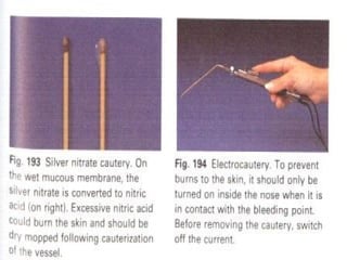 PENEMBUSAN GEGENDANG TELINGA | PPT