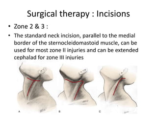 Penetrating-Neck-Injuries.pptx