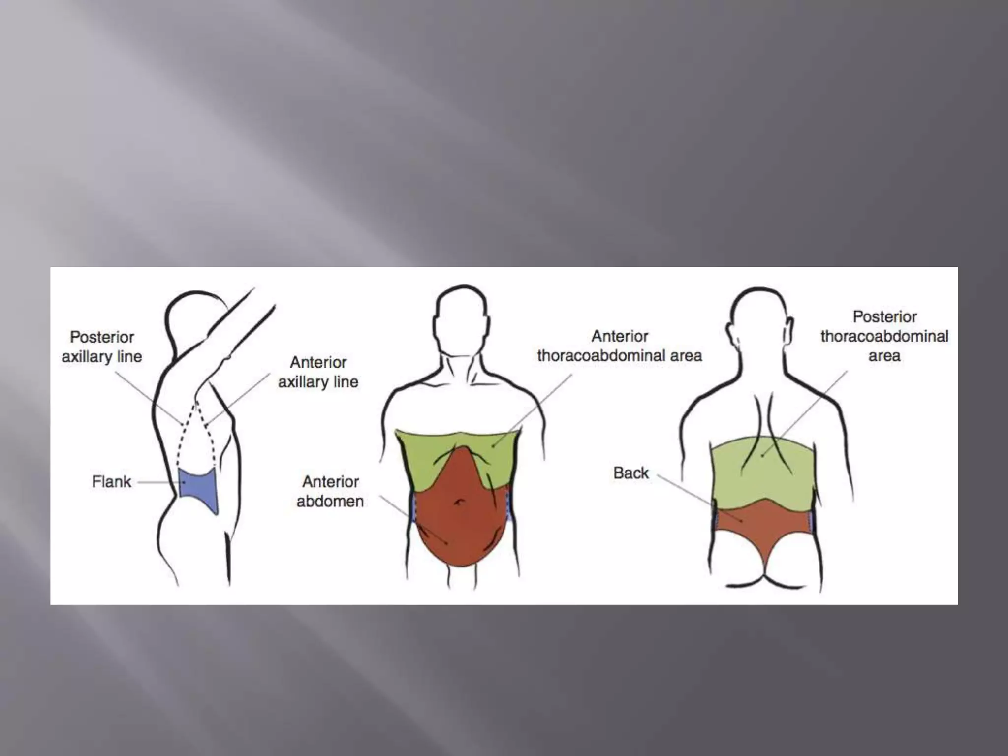 Penetrating Abdominal Trauma Emergency Management | PPTX