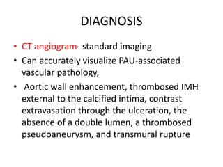 Penetrating aortic ulcer | PPTX
