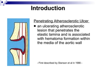 Penetrating Atherosclerotic Ulcer | PPT