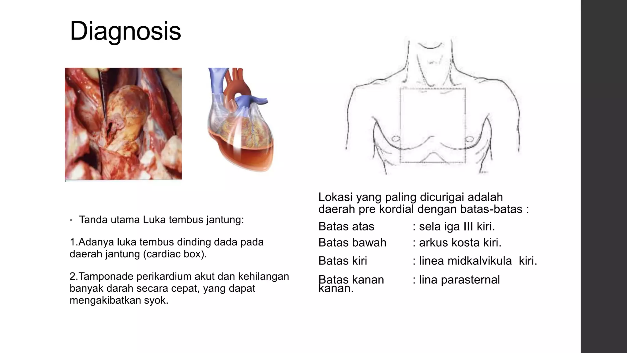 Penetrating cardiac injury | PPTX