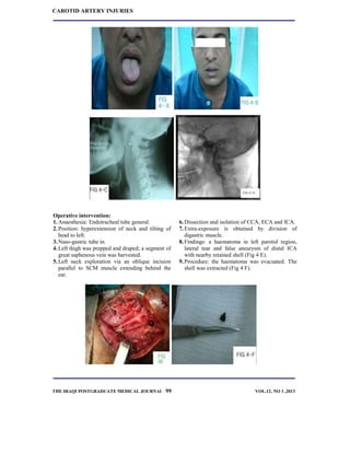 Penetrating carotid artery injuries | PDF