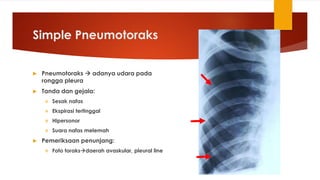 Penetrating Chest Injury.pdf