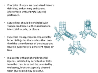 Penetrating chest trauma | PPTX