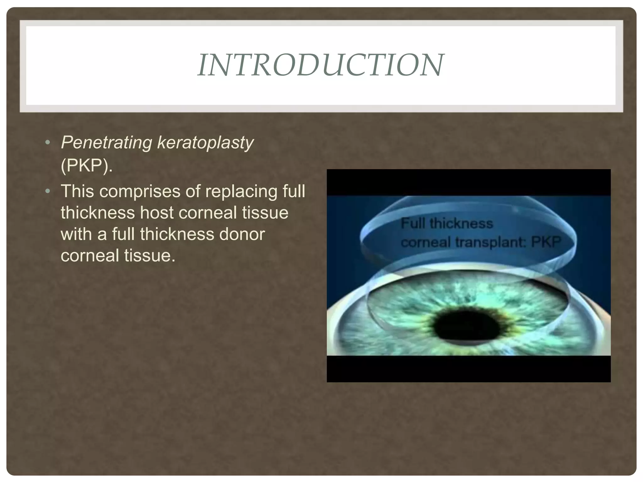 Penetrating keratoplasty | PPTX