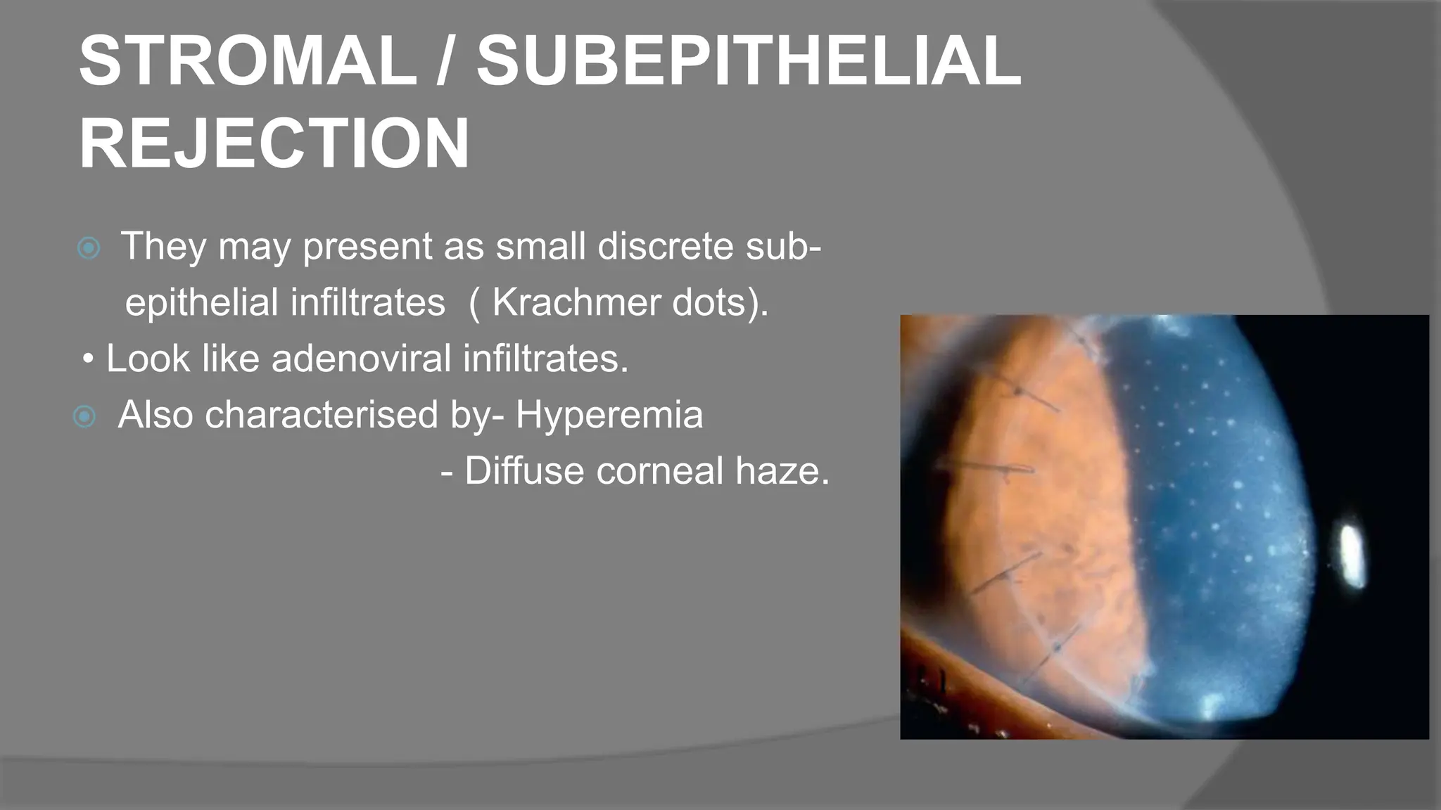 penetrating keratoplasty seminar ...pptx