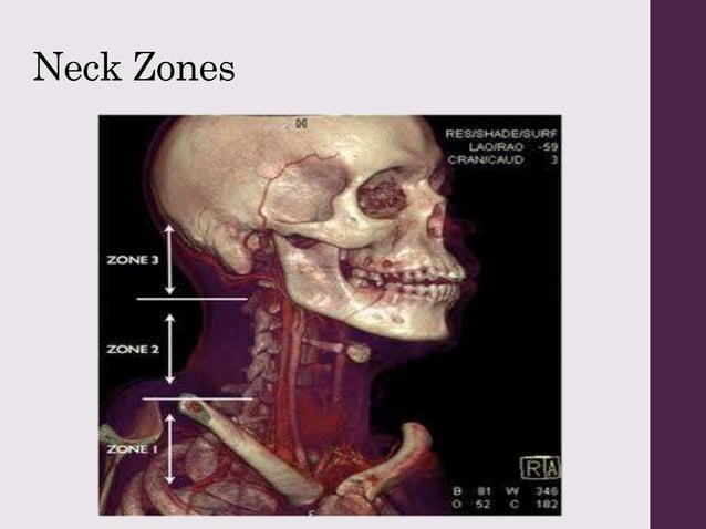 Penetrating neck trauma [autosaved] | PPTX