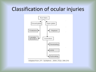 Penetrating Ocular Injuries | PPTX