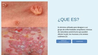 PENFIGO PERCY WILLIAMS MANEJO DERMATOLOGICO | PPTX