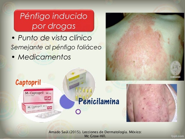 Penfigo y enfermedades ampollosas DERMATOLOGIA