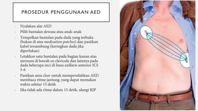 Pengenalan AED.pdf