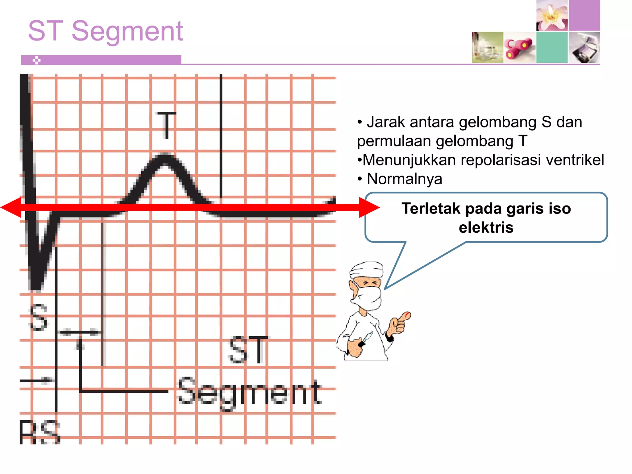 Pengenalan ekg dasar | PPTX