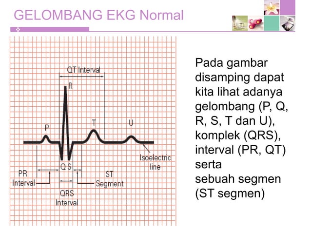 Pengenalan ekg dasar | PPTX