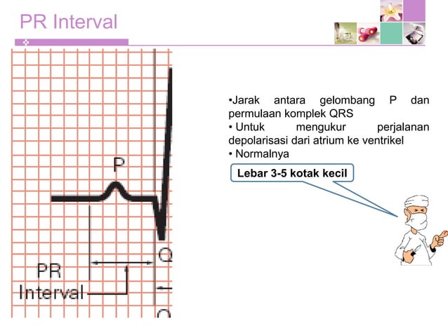 Pengenalan ekg dasar | PPTX