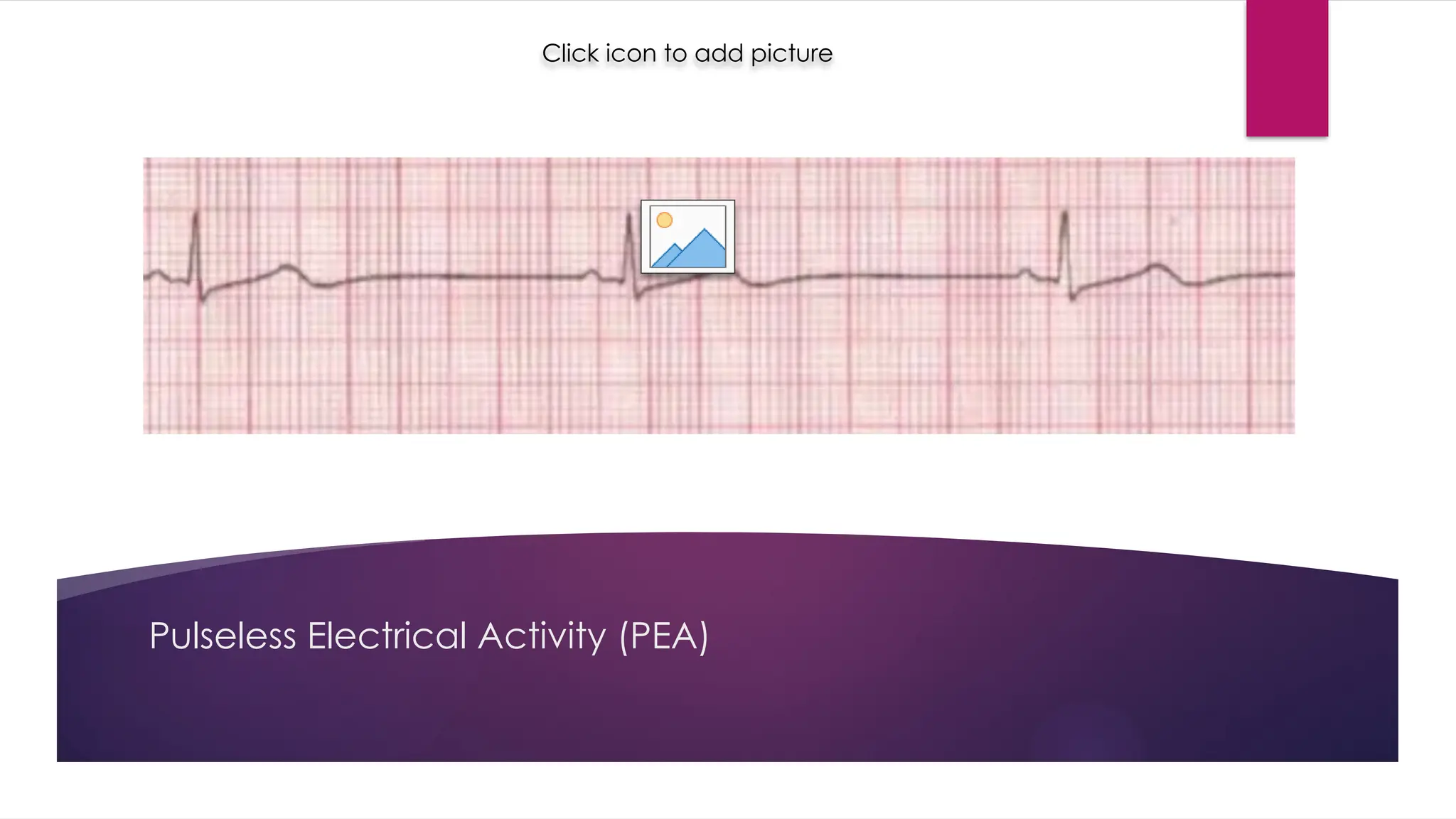 Pengenalan Irama Elektrokardiografi pada kasus emergency | PPTX