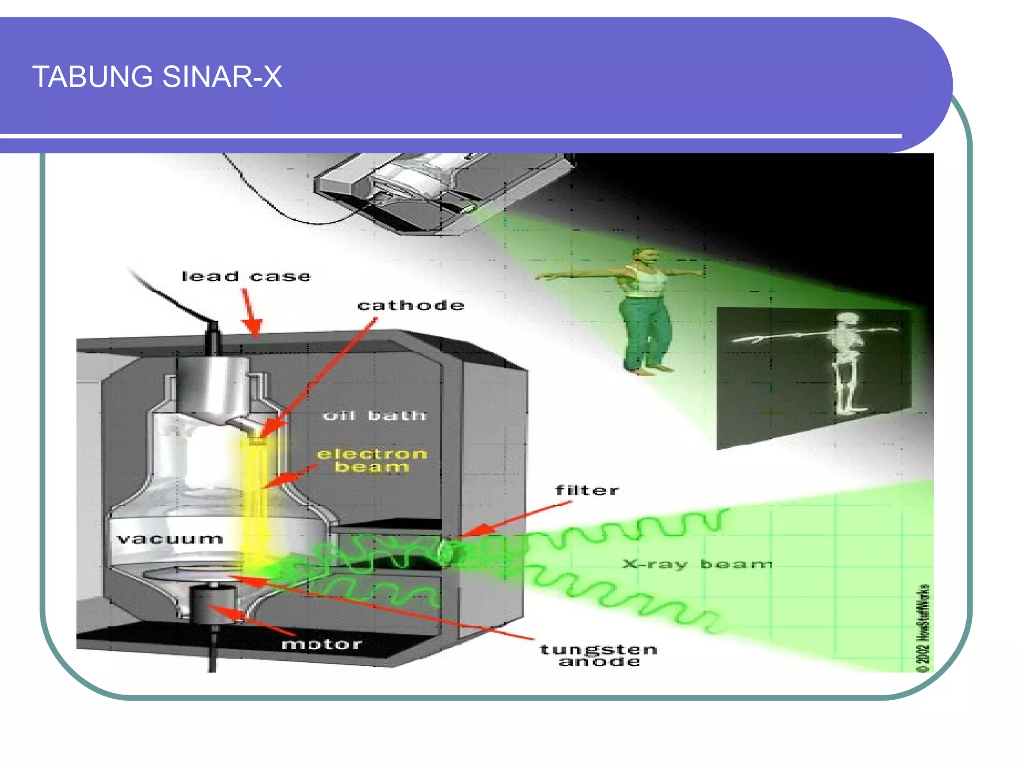 Pengenalan Pesawat Sinar X Diagnostik | PPT