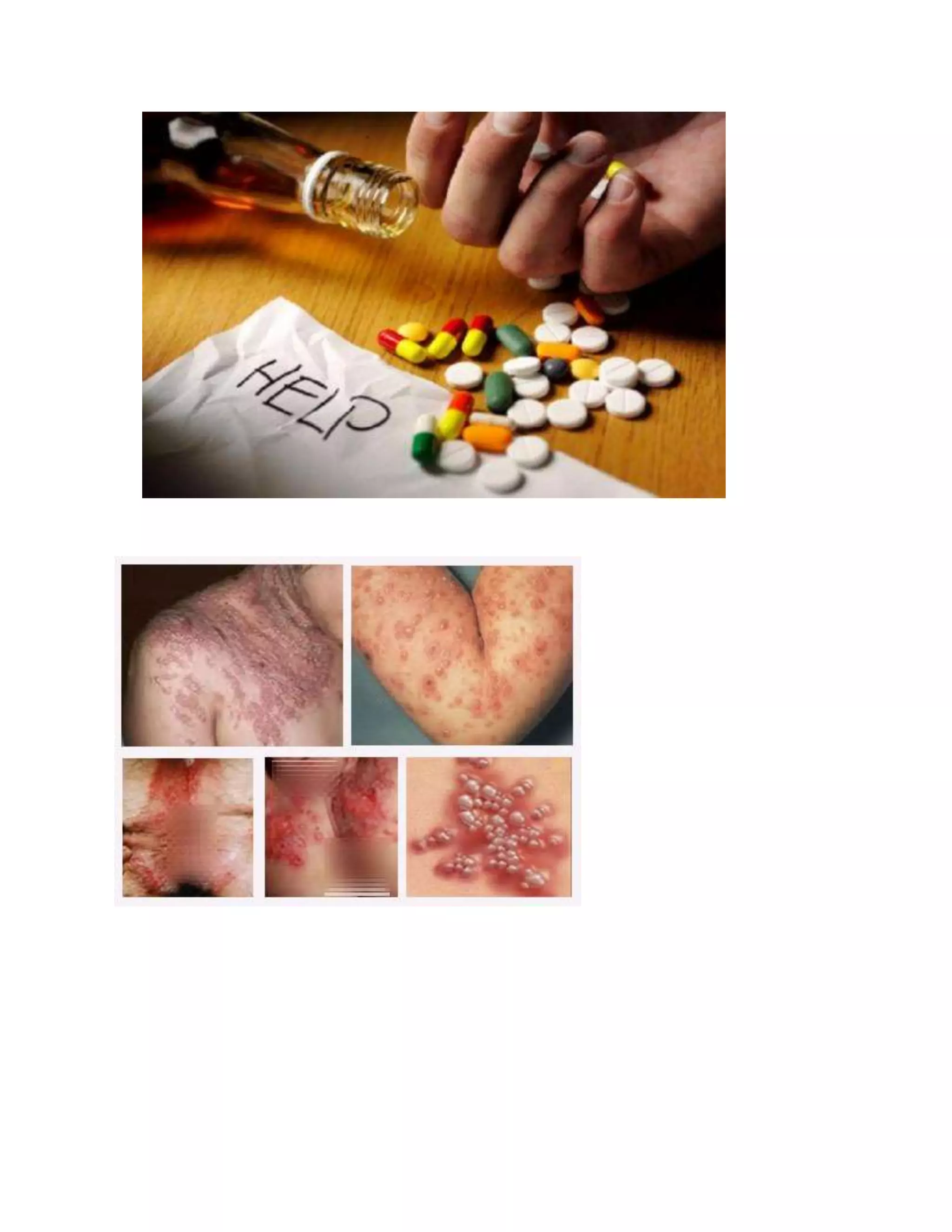 Pengertian seks-bebas | DOCX