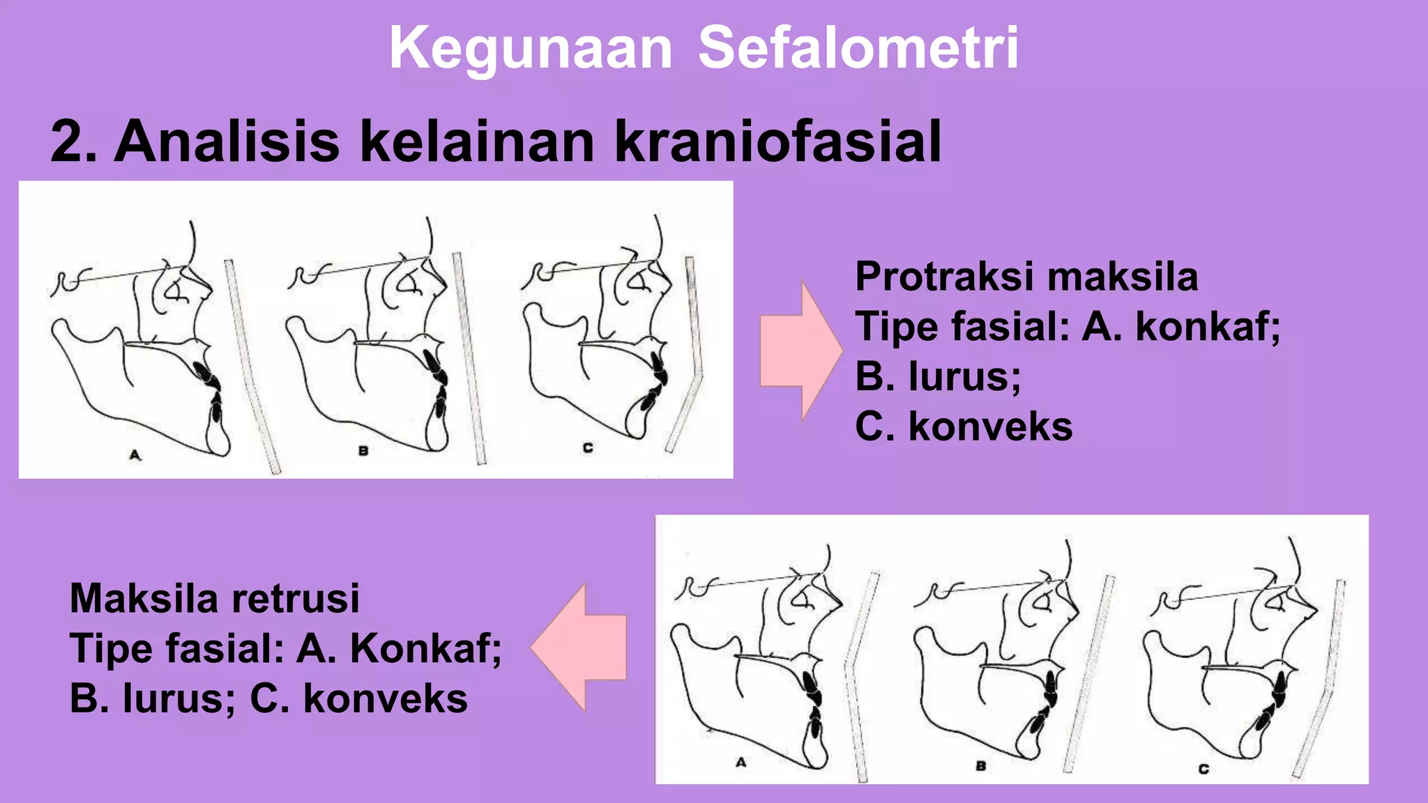 Pengertian Sefalometri .pptx