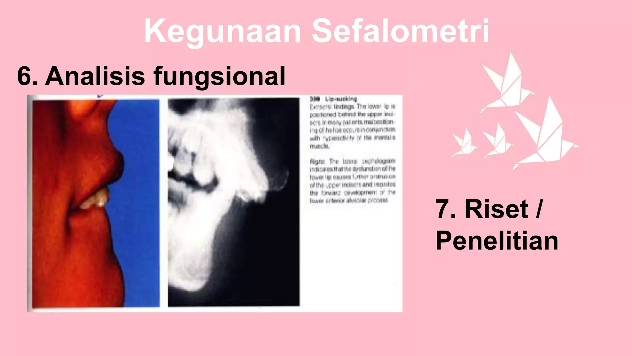 Pengertian Sefalometri .pptx